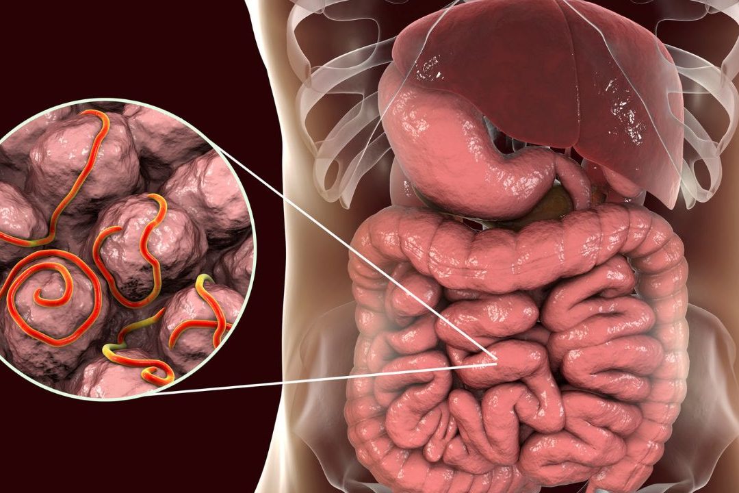 Les remèdes de grand-mère sont-ils efficaces pour se débarrasser des ...